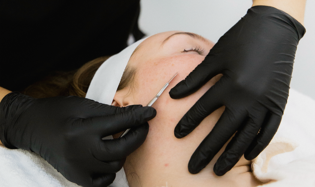 Your Party Ready Skin Guide - Naturaliste Skin Clinic
